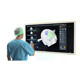 Brainlab Buzz Navigation (Ceiling-Mounted): AI Chat & PDF Download ...