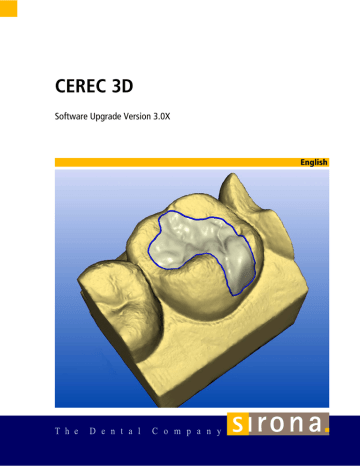 CEREC 3D Software Update Version 3.0X | Manualzz