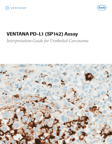 Roche VENTANA PD L1 (SP142) Assay Interpretation Guide | Manualzz
