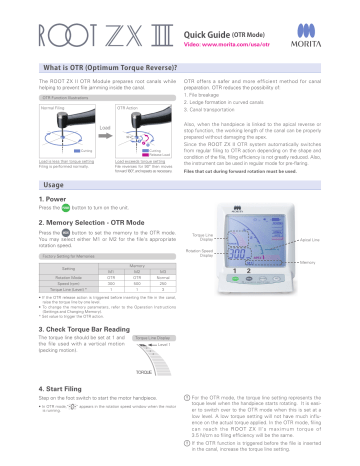 Morita ROOT ZX II Quick Manual | Manualzz
