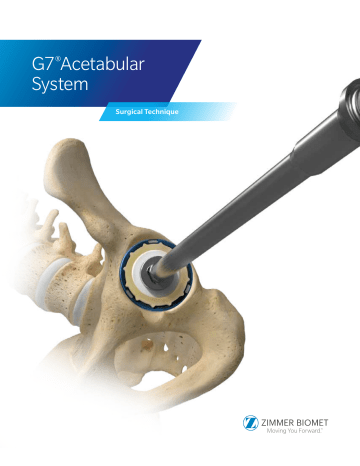 Zimmer G7 Acetabular System Owner's Manual | Manualzz