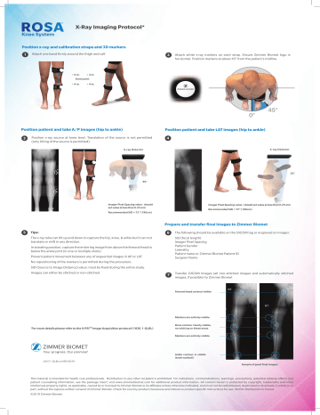 Zimmer ROSA Knee System Owner's Manual | Manualzz