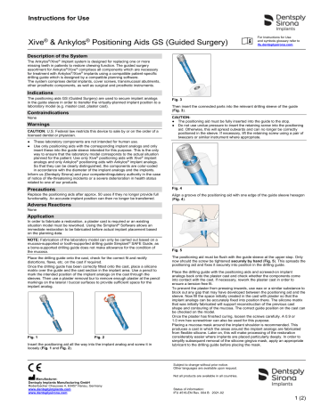 Dentsply Sirona Xive and Ankylos Positioning Aids Guided Surgery ǀ EN ǀ ...