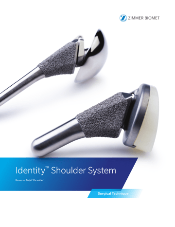 Zimmer Identity™ Shoulder System Owner's Manual | Manualzz