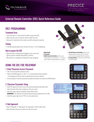 NuVasive PRECICE ERC1 Quick Reference Manual | Manualzz