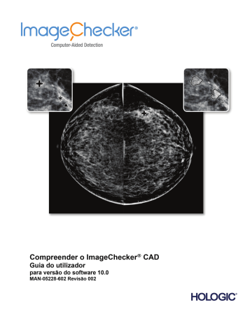 Hologic ImageChecker CAD Guia de usuario | Manualzz