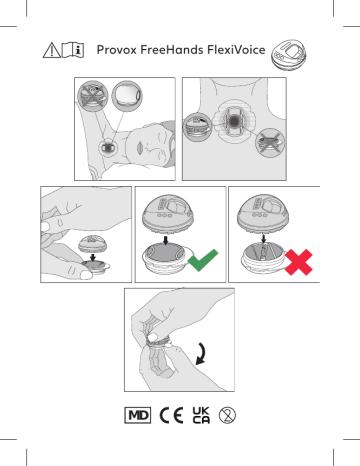 Atos Provox® Life™ FreeHands HME Instructions for use | Manualzz